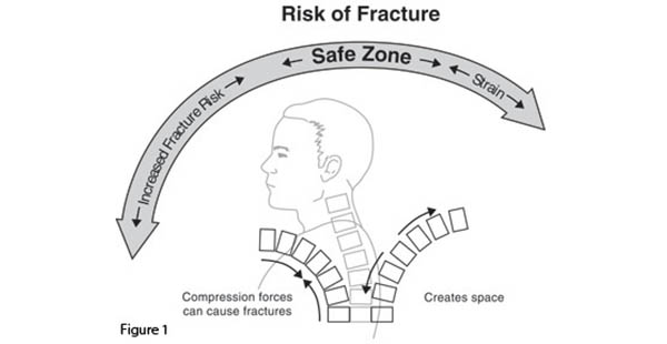Protecting Your Spine - Bone Health & Osteoporosis Foundation
